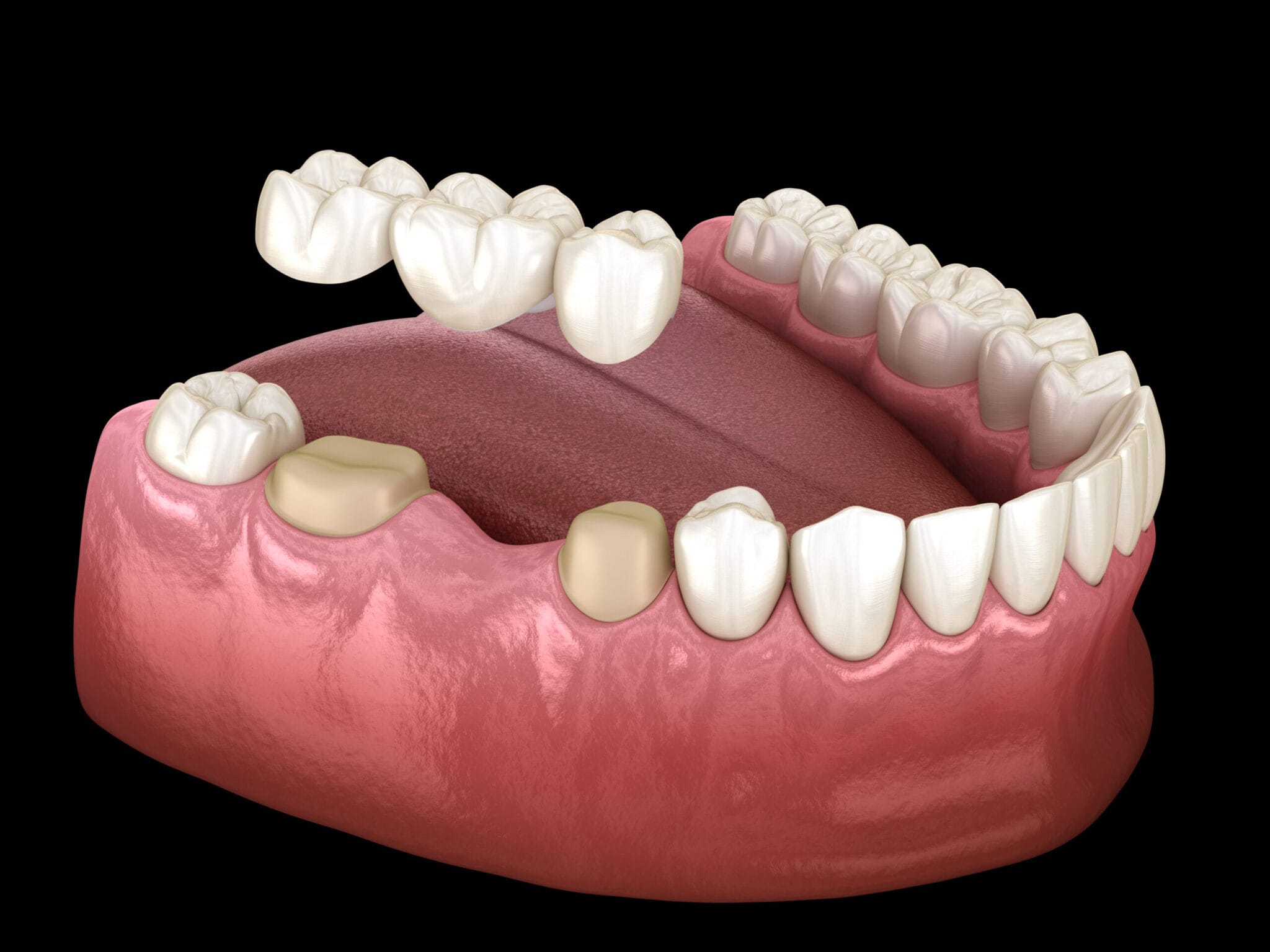 Swollen & Inflamed Taste Buds | What to Do & Not Do